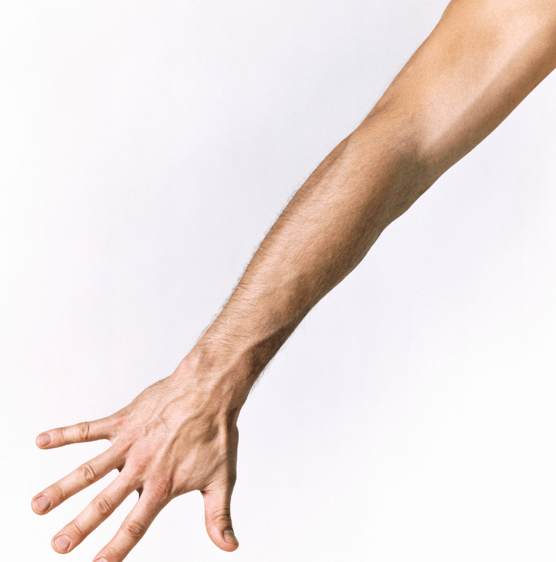 Arm Movement and the Detection of Stroke - Neuralert